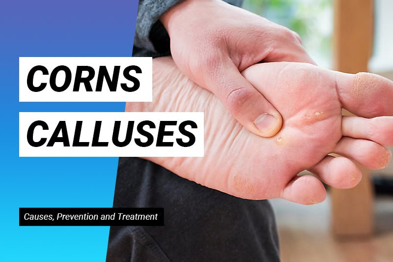 Corns and Calluses – FitVilleUK